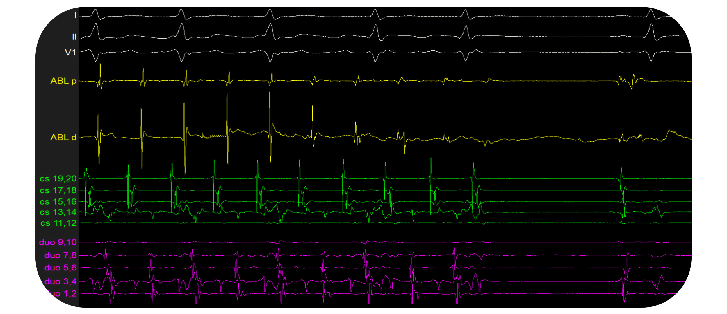 Our Solution :: BioSig Technologies, Inc. (BSGM)