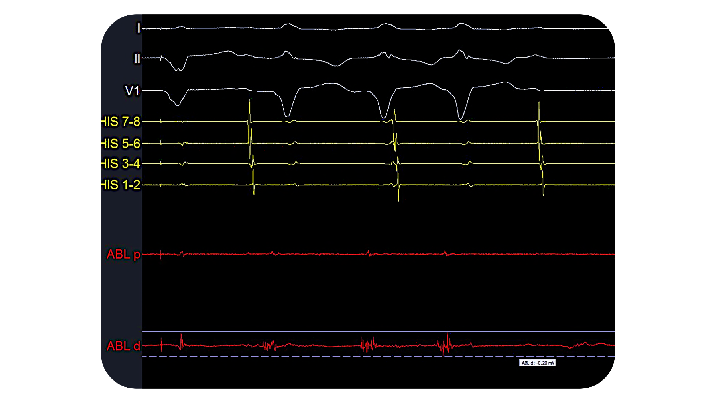 Our Solution :: BioSig Technologies, Inc. (BSGM)