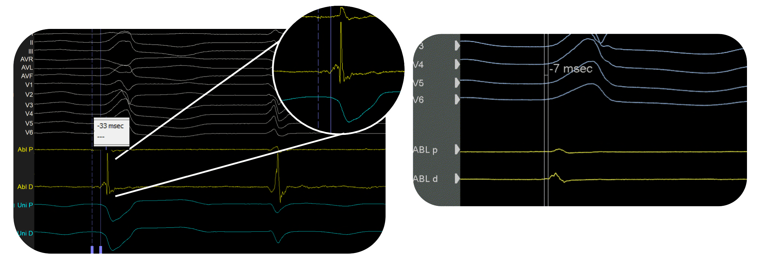 Our Solution :: BioSig Technologies, Inc. (BSGM)