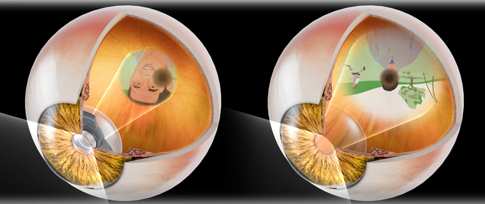 SING IMT™ :: Samsara Vision, Inc. (Europe)